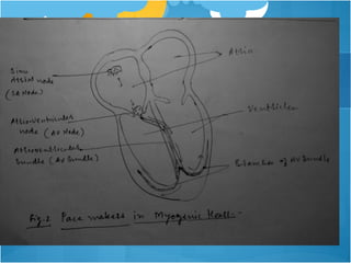 Neurogenic and myogenic hearts | PPT