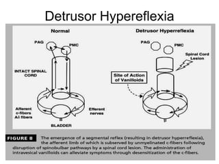 Neurogenicbladder 140711115804-phpapp01 | PPTX