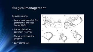 Neurogenic bladder | PPT