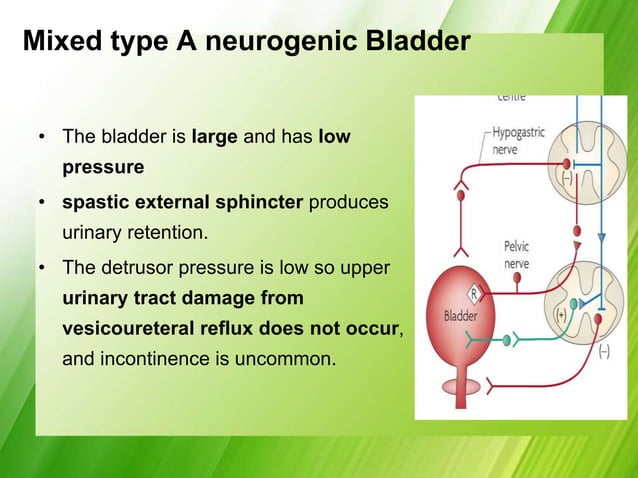 Neurogenic bladder | PPTX | Brain and Nervous System Disorders ...