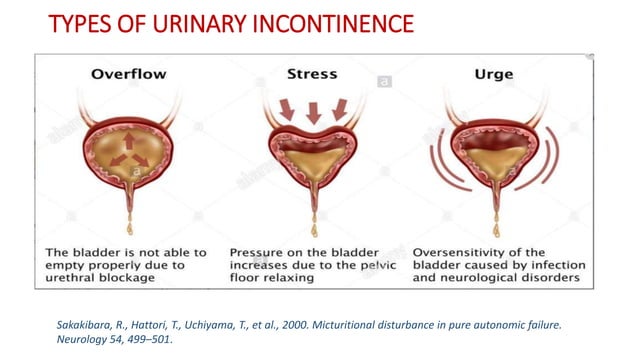 NEUROGENIC BLADDER.pptx