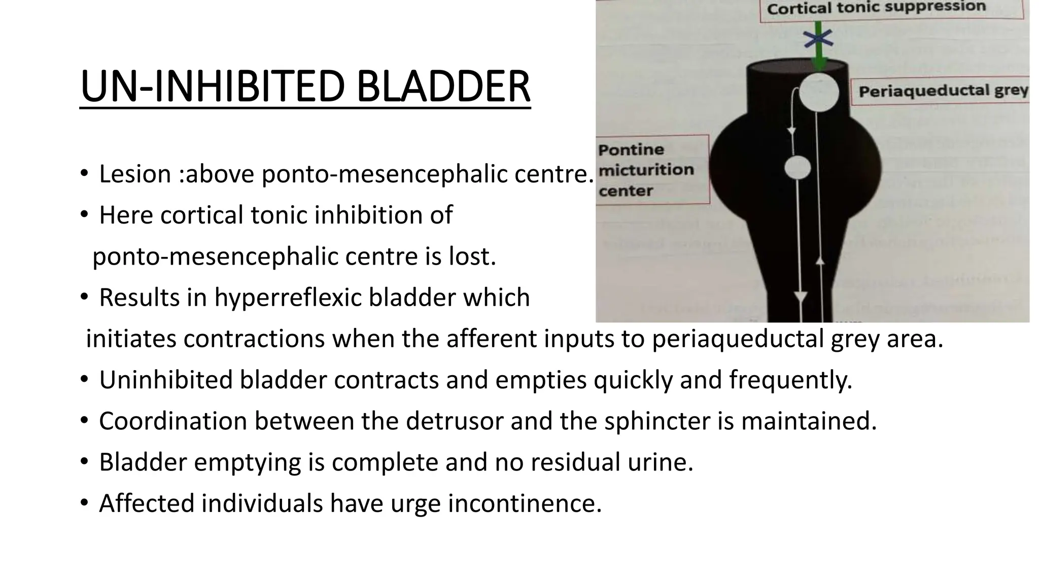NEUROGENIC BLADDER.pptx