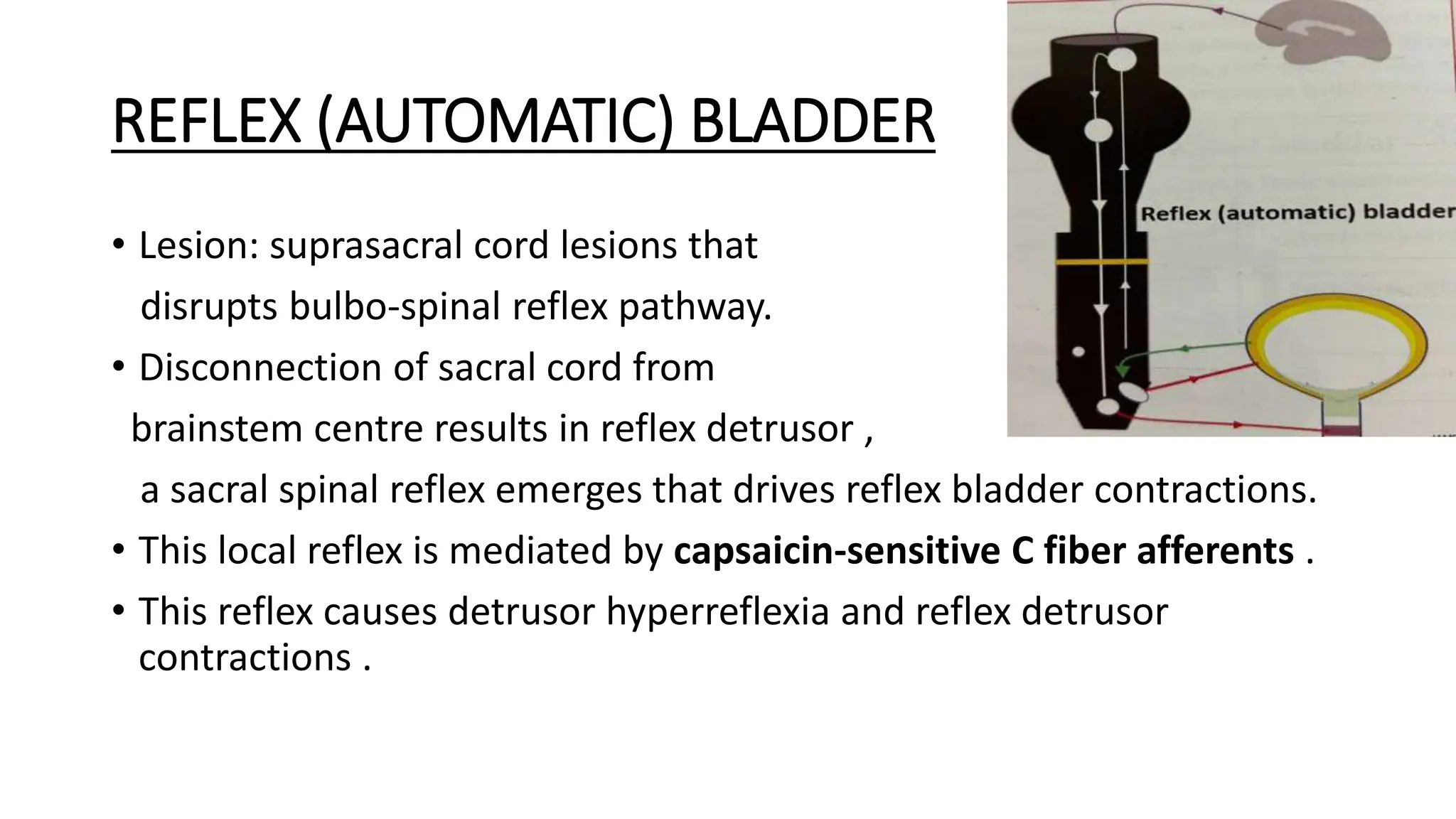 NEUROGENIC BLADDER.pptx