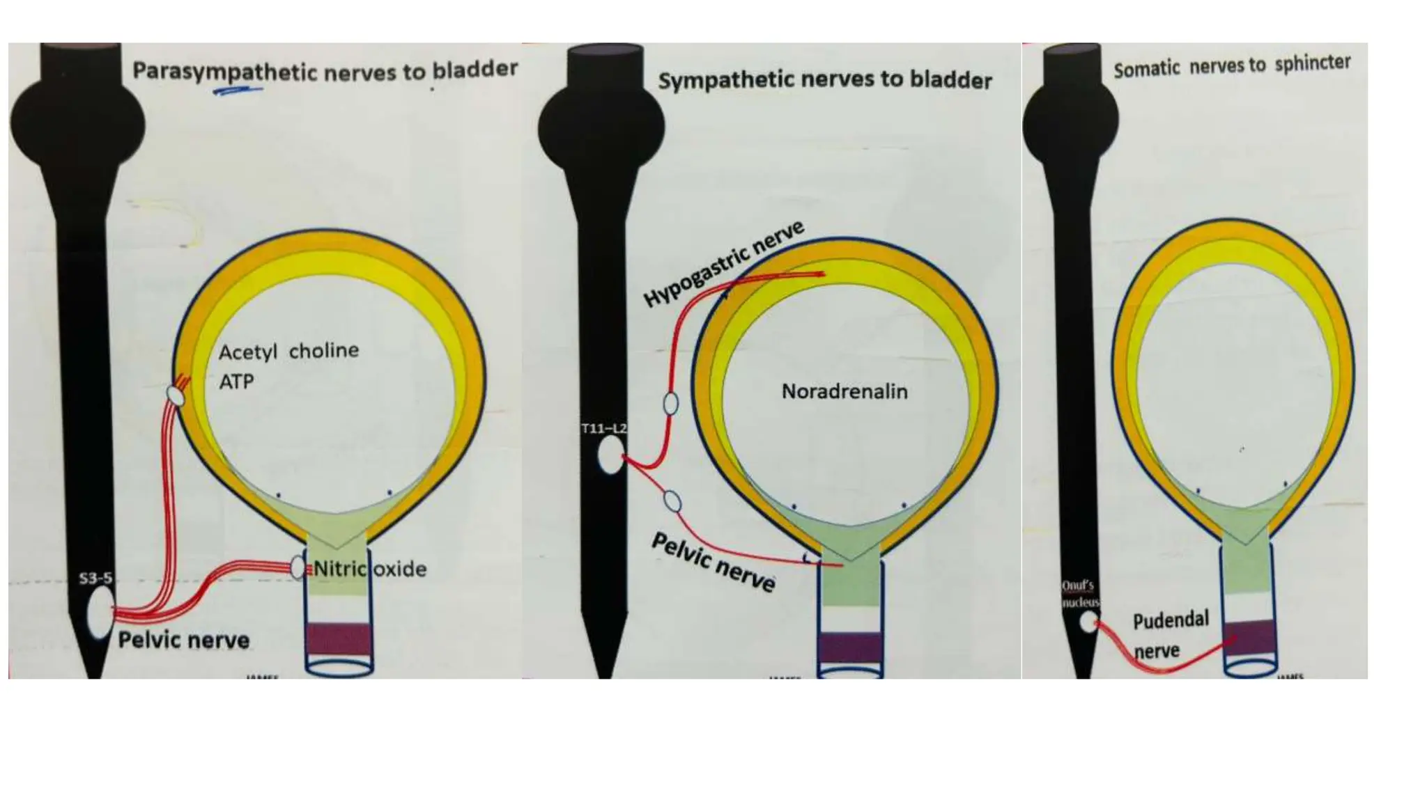 NEUROGENIC BLADDER.pptx