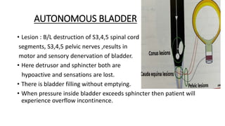 NEUROGENIC BLADDER.pptx