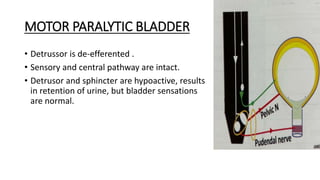 NEUROGENIC BLADDER.pptx