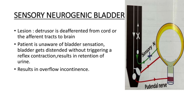 NEUROGENIC BLADDER.pptx