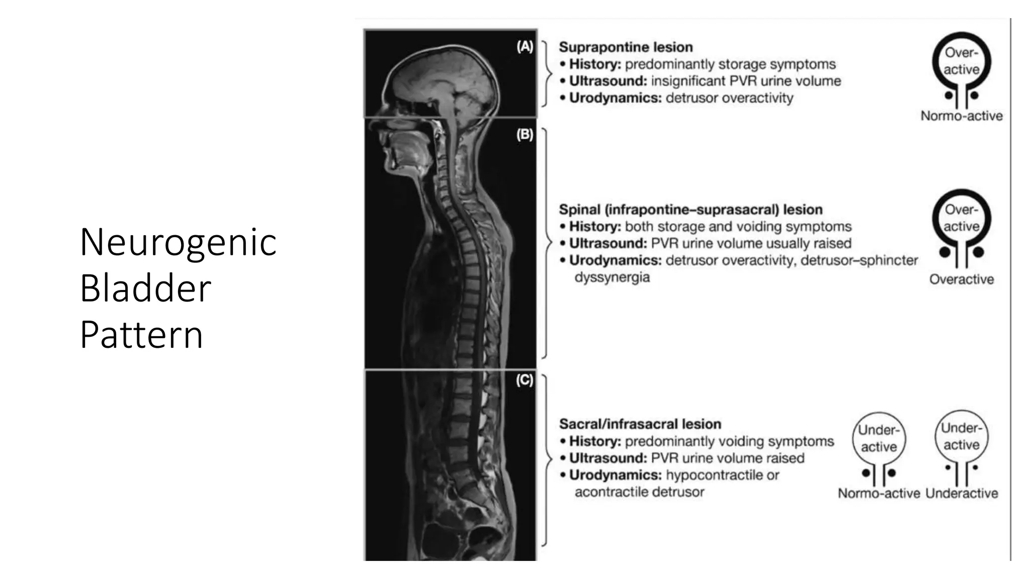 Neurogenic bladder based on EAU 2023.pptx