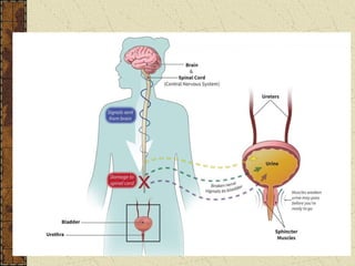 Neurogenic bladder AND ITS MANAGEMENT.ppt