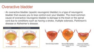 presentation on neurogenic bladder including anatomy | PDF