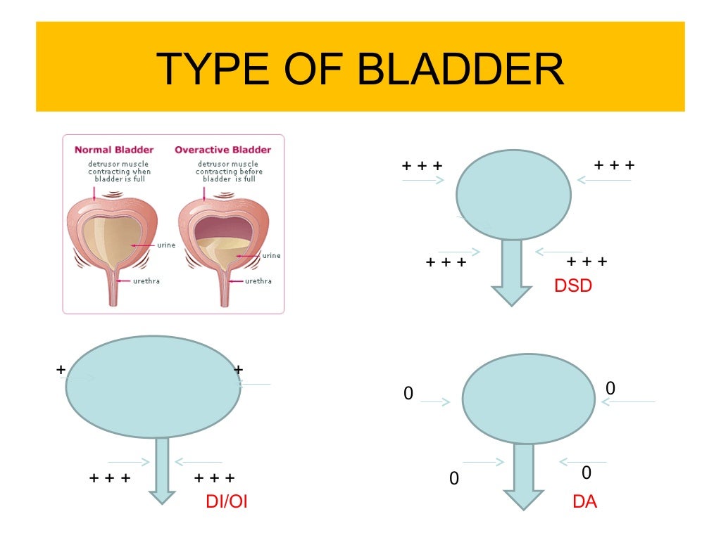 Neurogenic Bladder