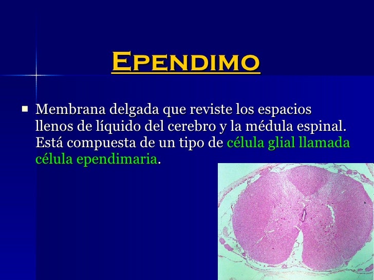 Neuroglia!!