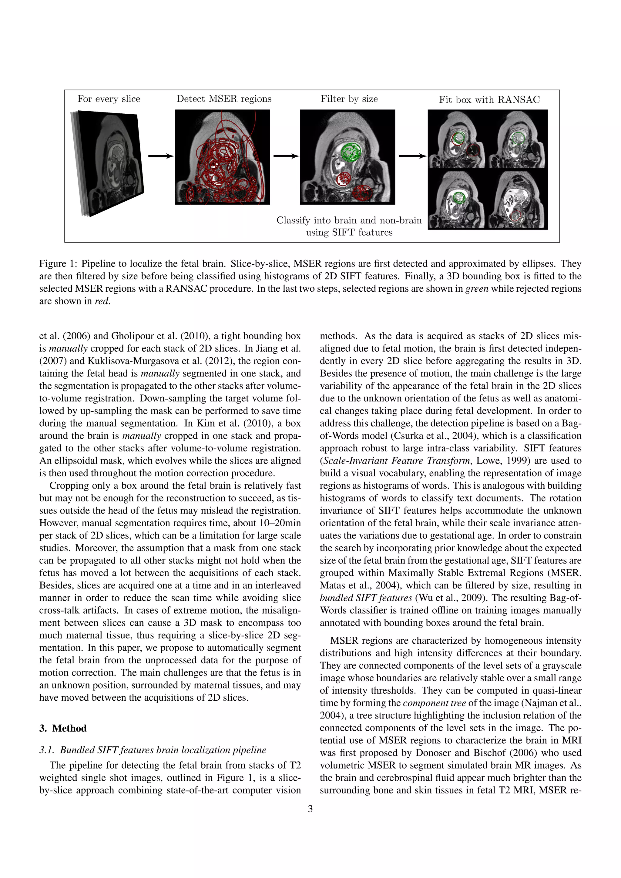 Automated Fetal Brain Segmentation From 2d Mri Slices For Motion