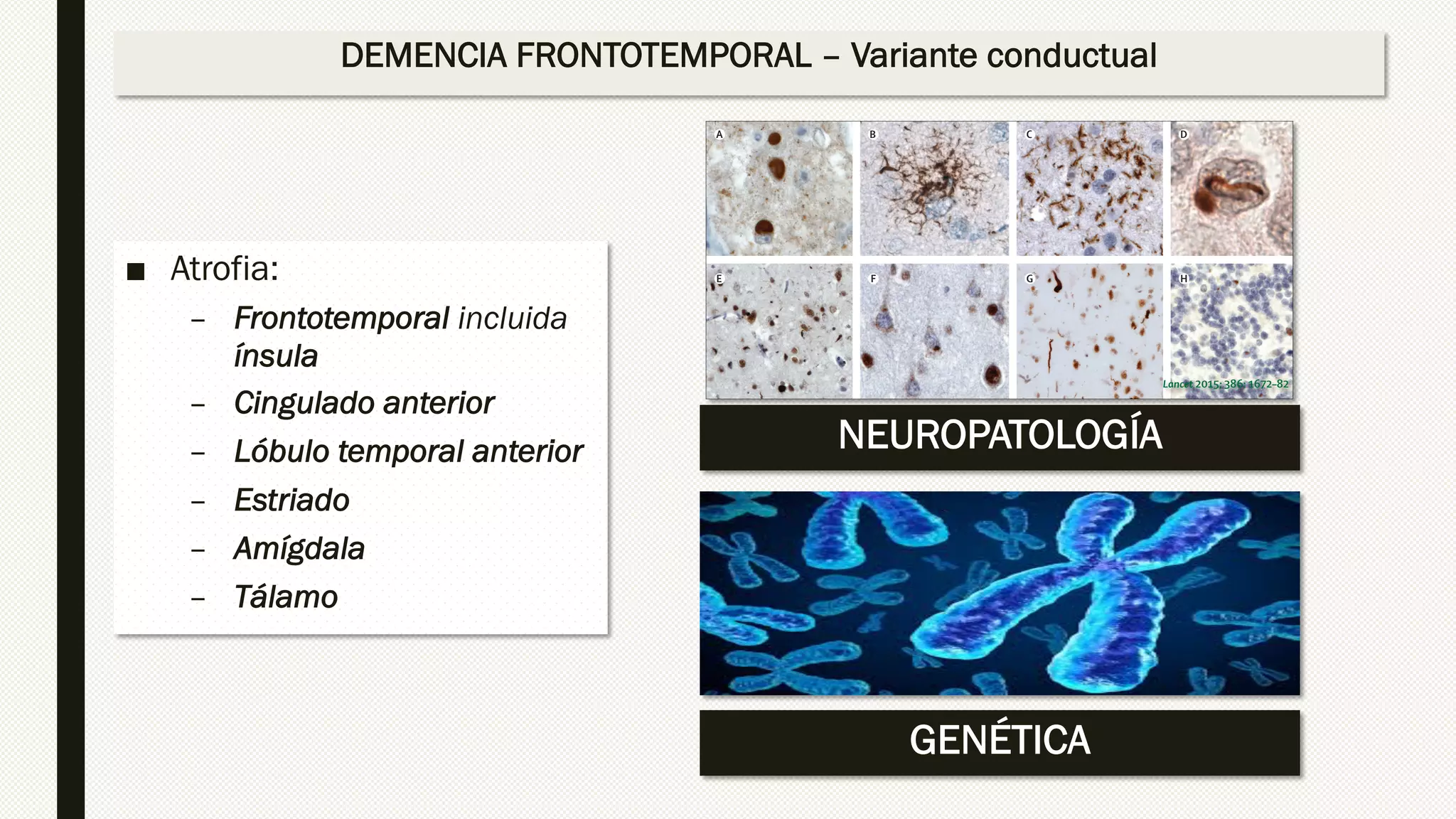 Neuroimagen estructural demencias | PDF