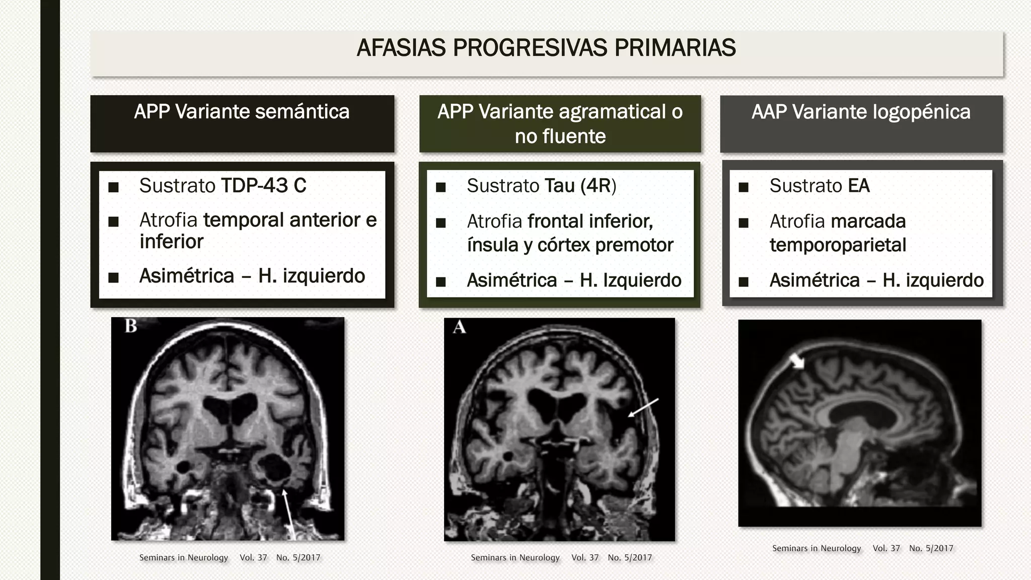 Neuroimagen estructural demencias | PDF