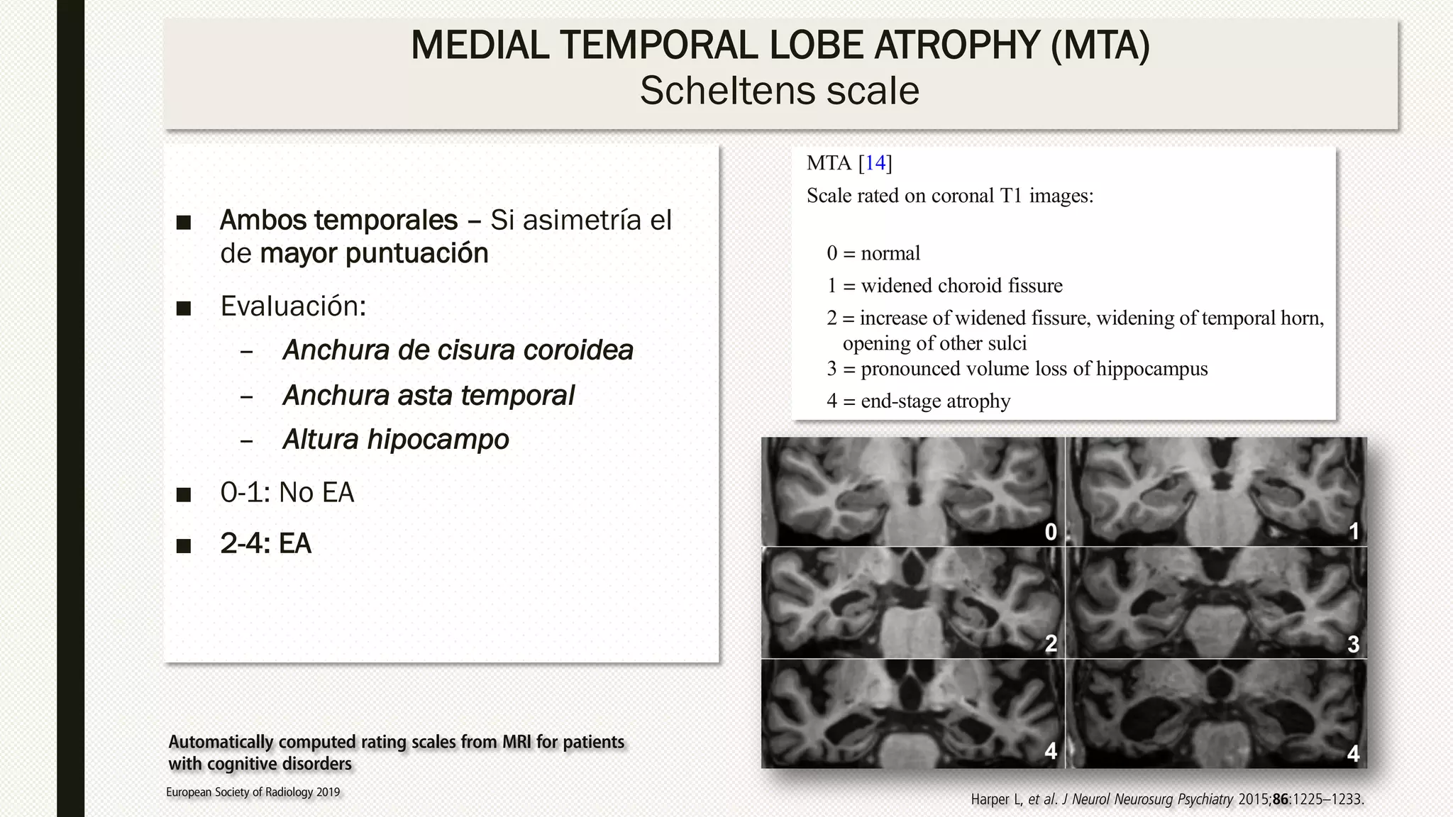 Neuroimagen estructural demencias | PDF