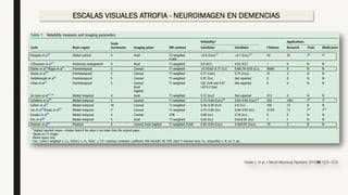 Neuroimagen estructural demencias | PPT