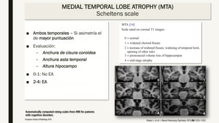 Neuroimagen estructural demencias | PPT
