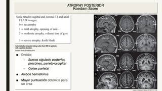 Neuroimagen estructural demencias | PPT