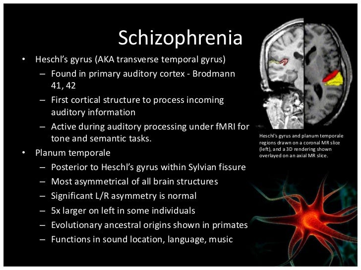 Neuroimaging Neuroimaging