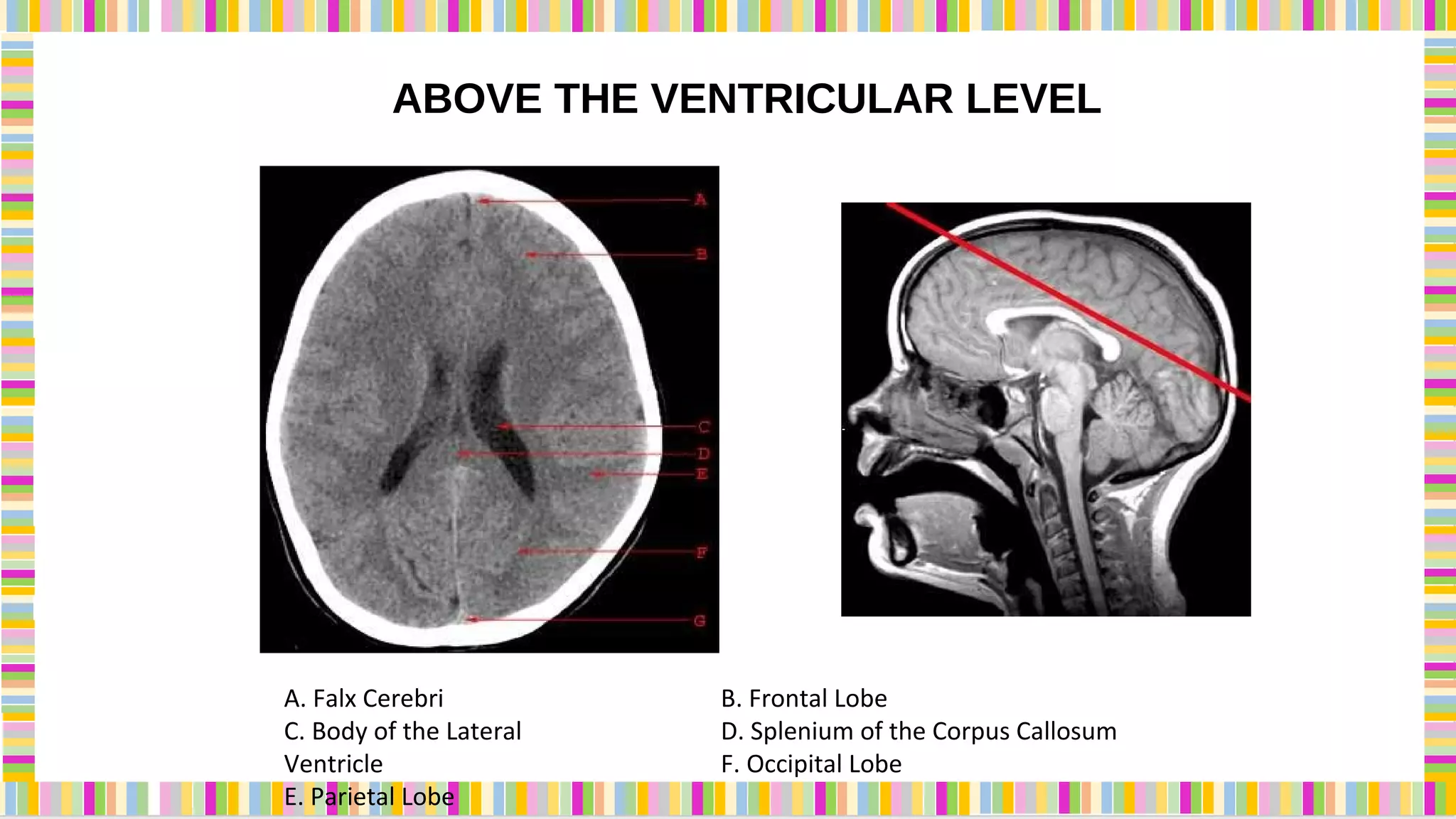 Neuroimaging in Psychiatry | PPT