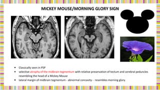 Neuroimaging in Psychiatry | PPT