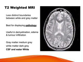 Neuroimaging in Psychiatry | PDF