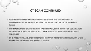 Neuroimaging in Ophthalmology indications.pptx