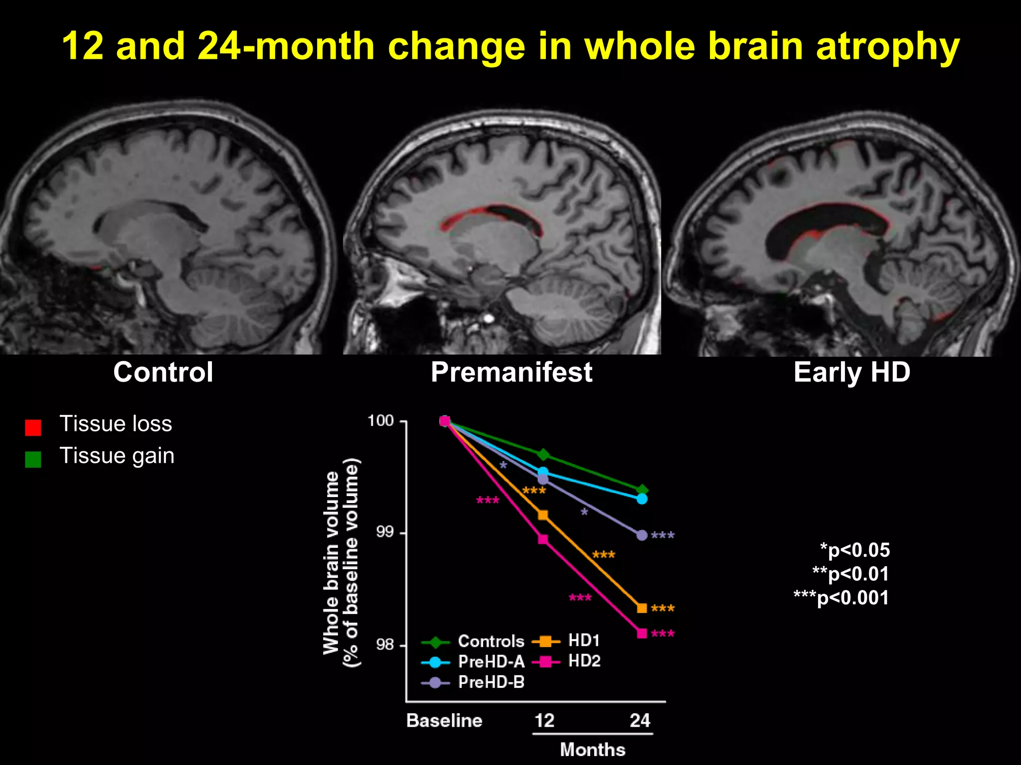 Neuroimaging for HD: Successes and Future Applications