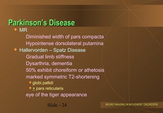 Neuro imaging in movement disorders | PPT
