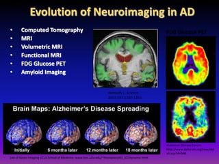 Neuroimaging of alzheimer's | PPTX