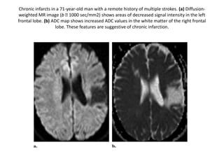 Neuroimaging teddy | PPTX