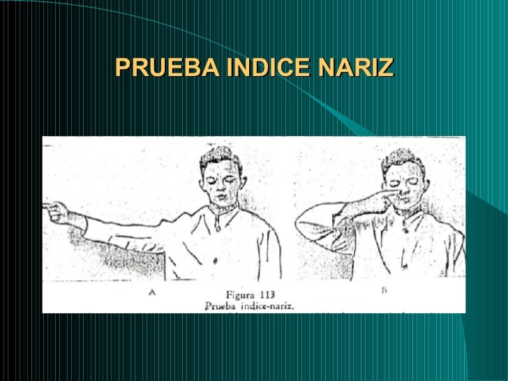 neurologia