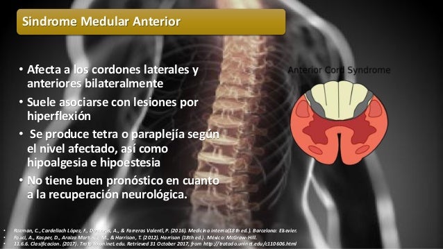 Lesiones Medulares