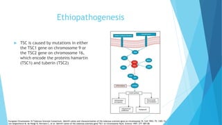 Neurological Aspects of Tuberous Sclerosis | PPTX