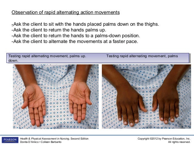 Neurological assessment