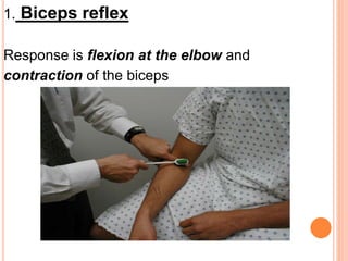 Neurological assessment | PPTX