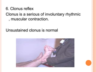 Neurological assessment | PPTX