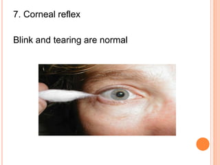 Neurological assessment | PPTX