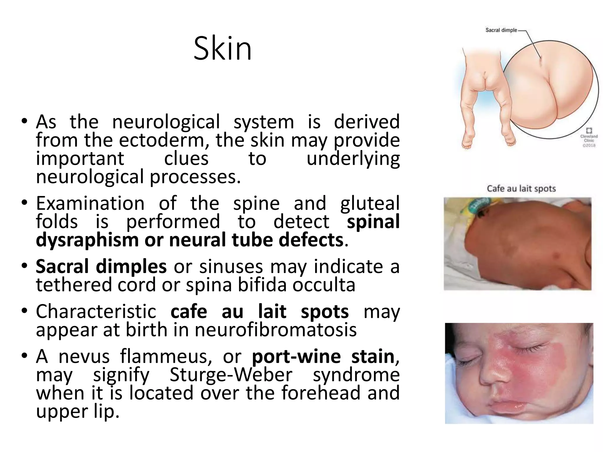 Neurological assessment seminar | PPTX