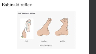 NEUROLOGICAL ASSESSMENT.ppt