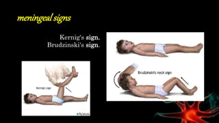 Assessment of Pediatric Nerves System | PPT