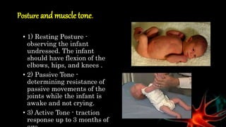 Assessment of Pediatric Nerves System | PPT
