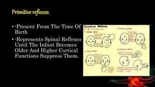 Assessment of Pediatric Nerves System | PPT