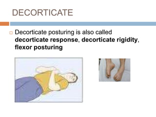 Neurological assessment For Nurses | PPTX