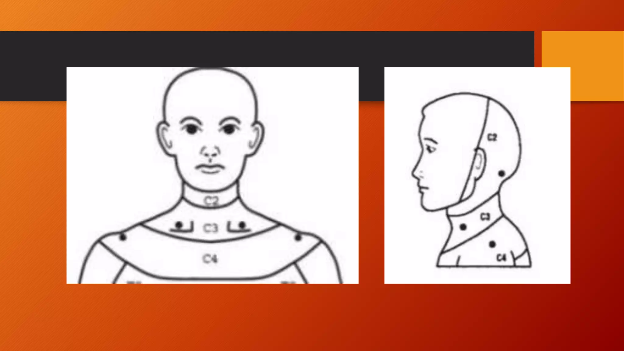 Neurological assessment for asia chart | PPTX