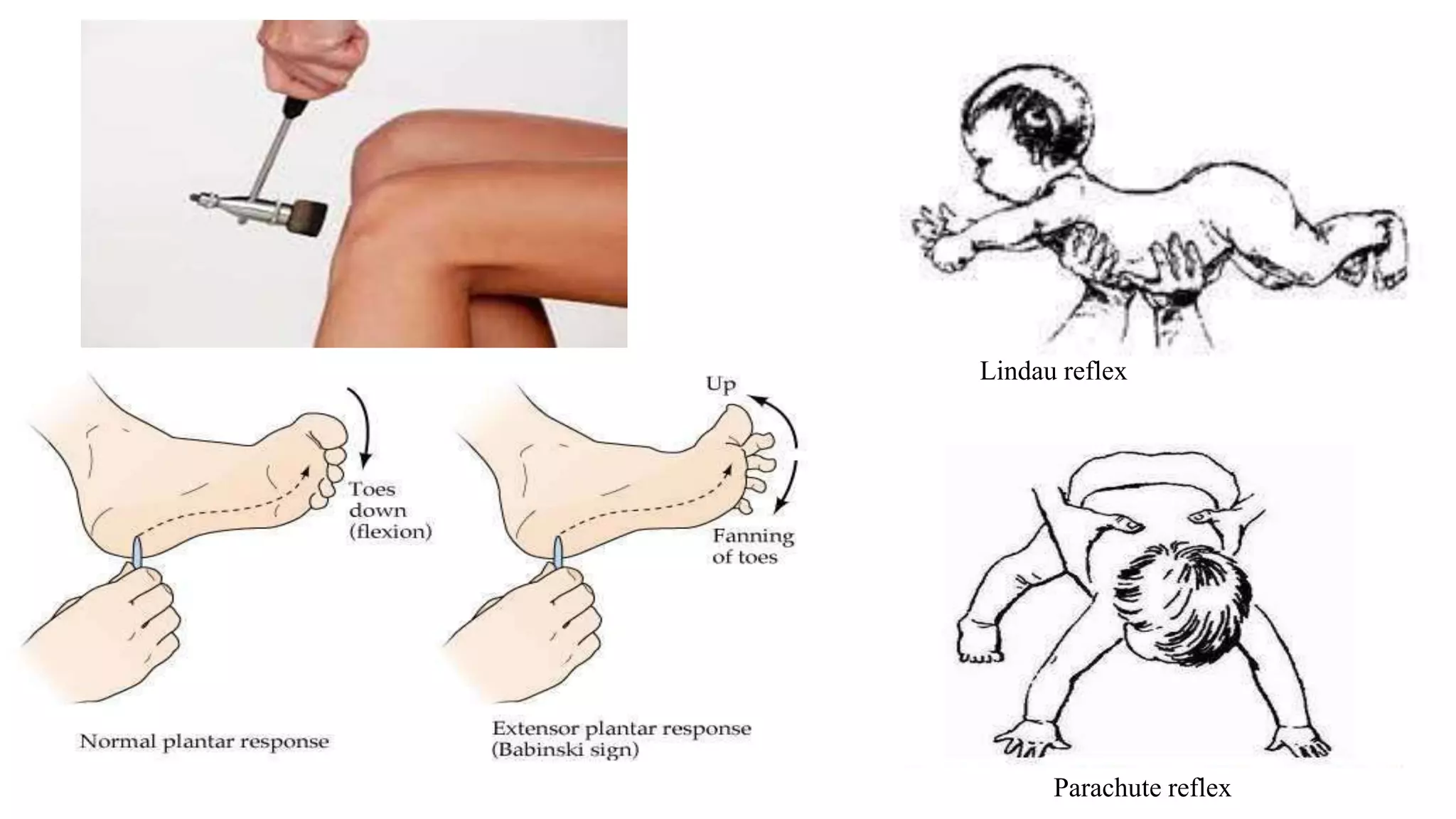 Neurological assessment of child | PPTX