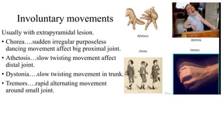 Neurological assessment of child | PPTX