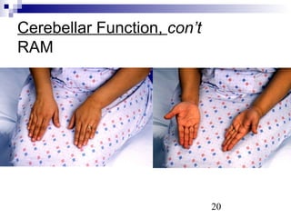 Neurological assessment sp07 webversion | PPT