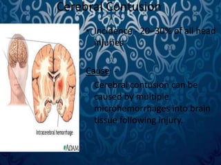 Neurological complications in omfs trauma by Dr. Amit Suryawanshi .Oral ...